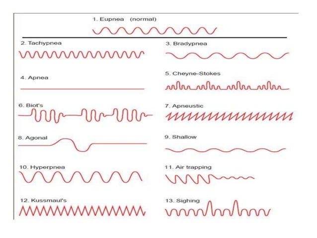 Stethograph- Recording Respiratory Movements | PPTX | Lung and ...