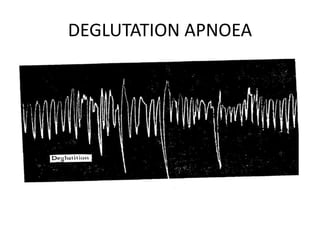Stethograph- Recording Respiratory Movements | PPTX