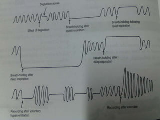 Stethography by Pandian M | PPTX