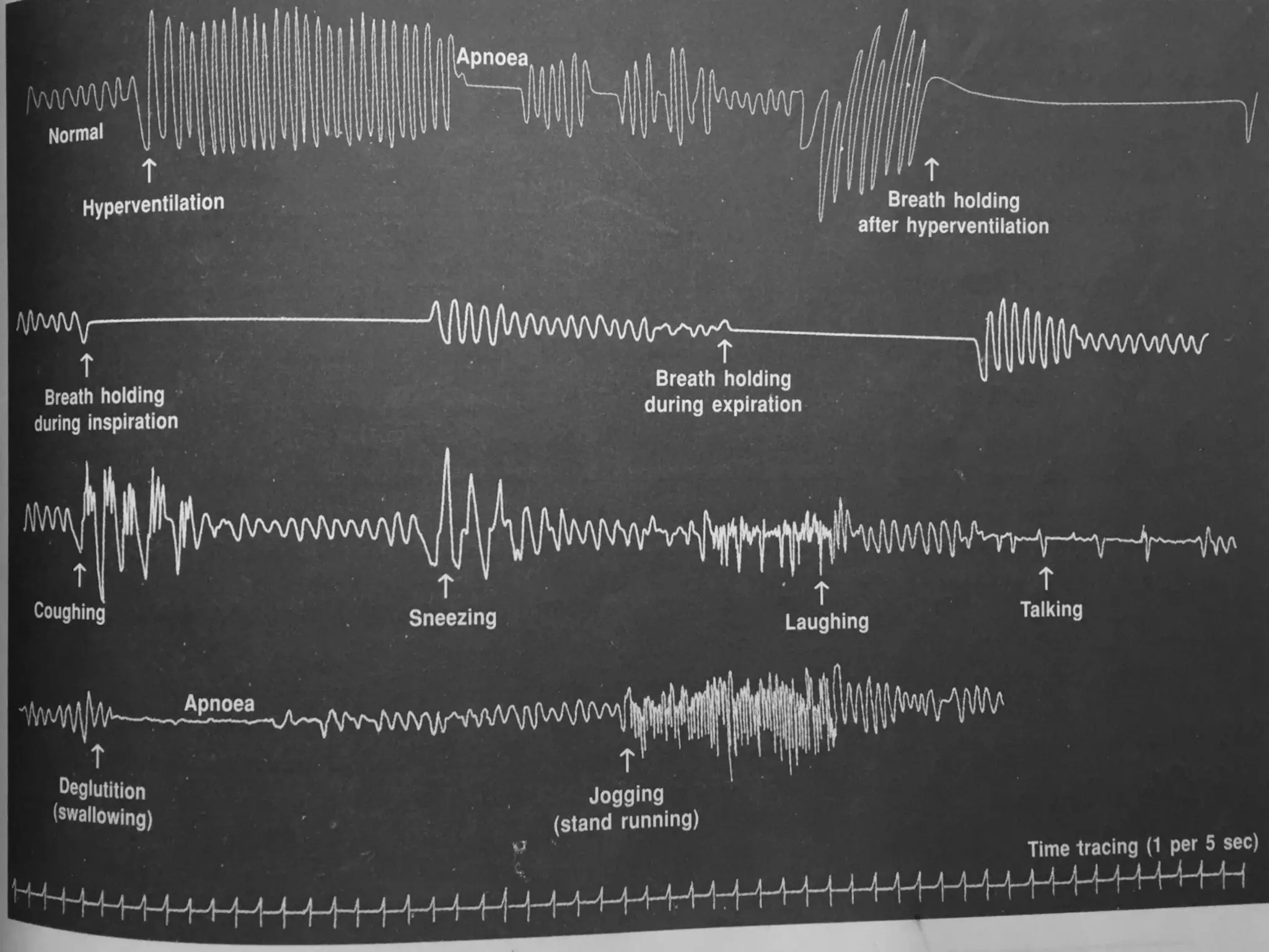 STETHOGRAPHY.CLINICAL PRACTICAL DEMONSTRATION | PPTX