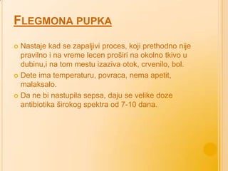 Stevanovic jelena iv6 | PPTX