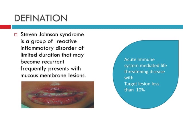 Clinical Manaagement of Aushadha Anurjata Vyadhi w.s.r.t. Steven ...