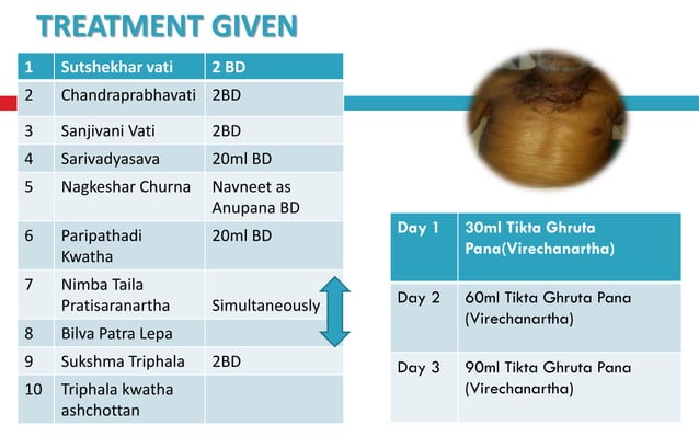 Clinical Manaagement of Aushadha Anurjata Vyadhi w.s.r.t. Steven ...