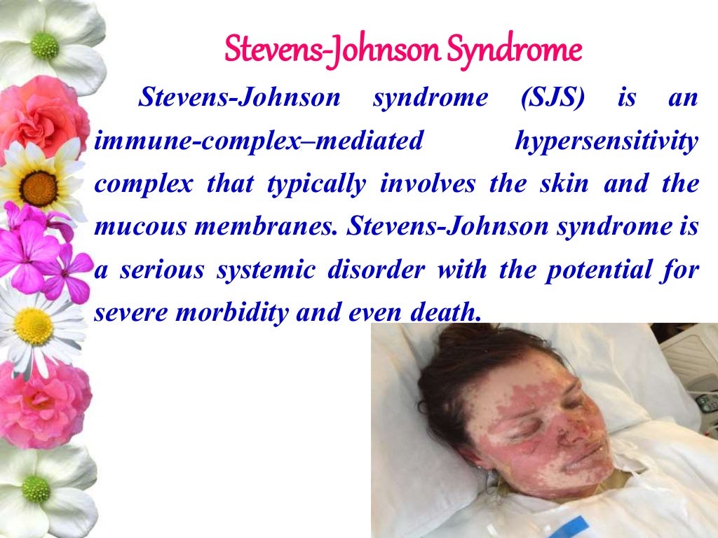 Steven johnson syndrome-