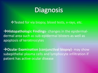 Stevens-Johnson Syndrome | PPTX