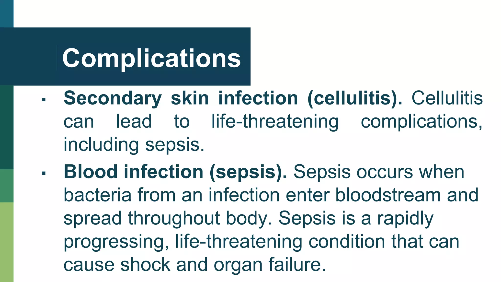 Stevens johnson syndrome | PPTX