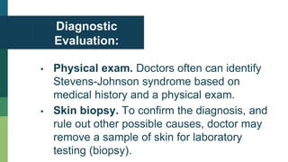Stevens johnson syndrome | PPTX