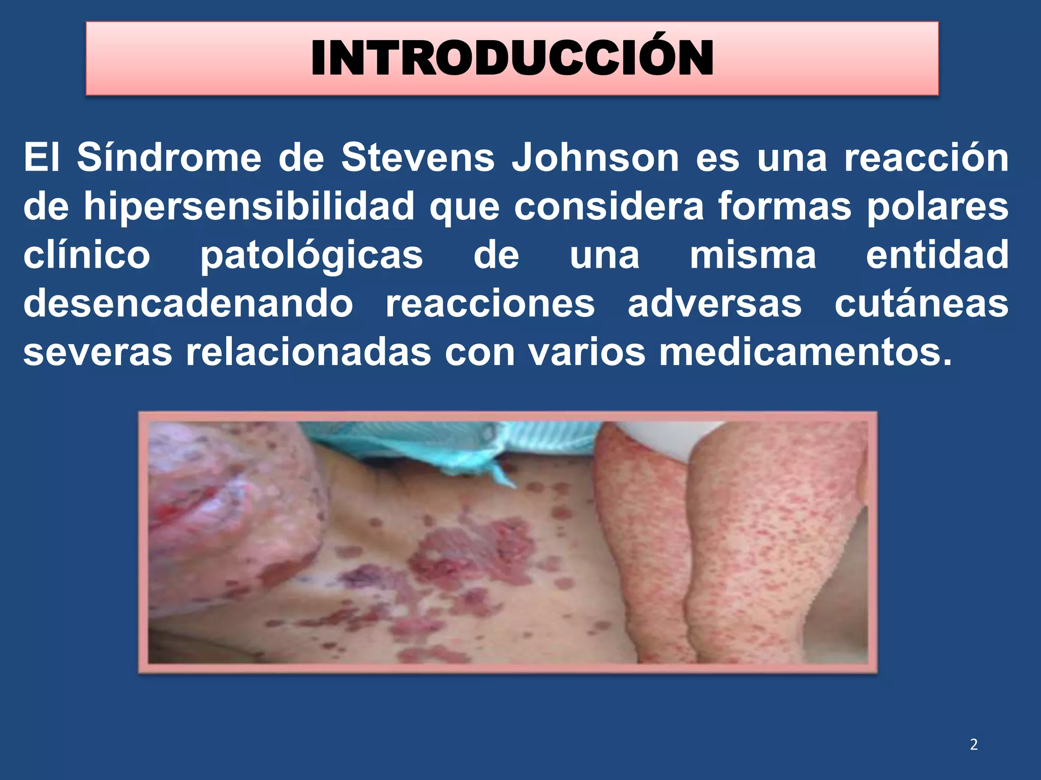 Stevens Johnson Y Necrolisis Epidermica Toxica | PPT
