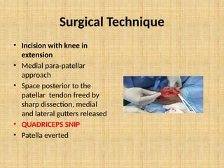 STFF KNEE IN TOTAL KNEE ARTHROPLASTYTKA .pptx