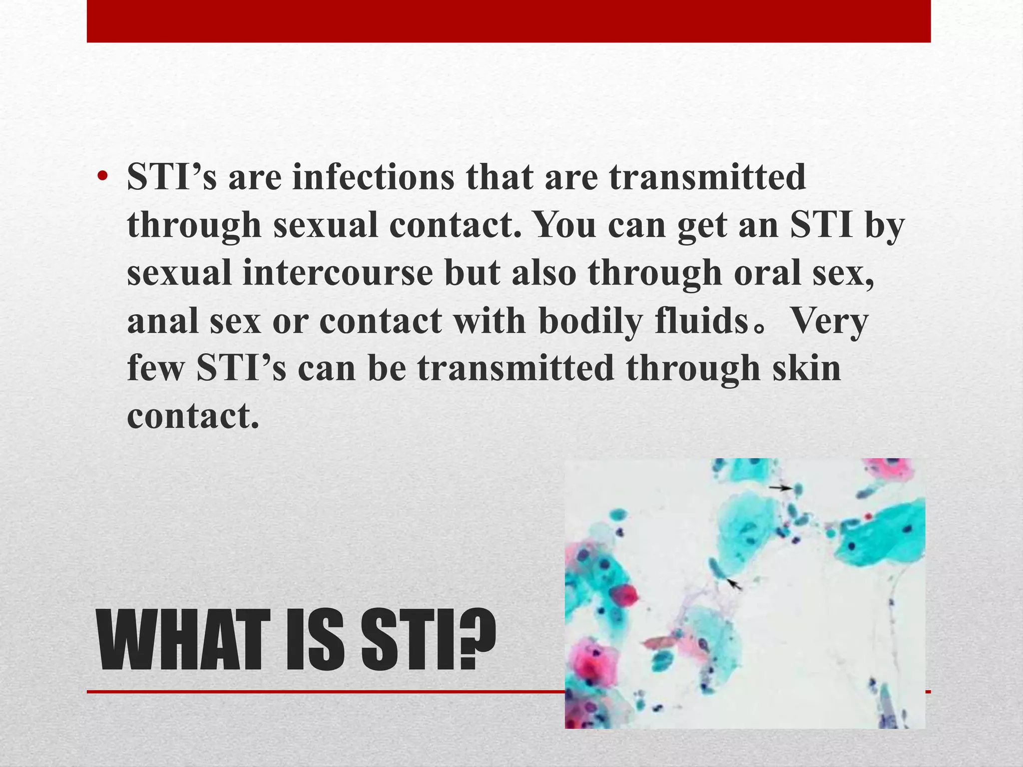 STI | PPT