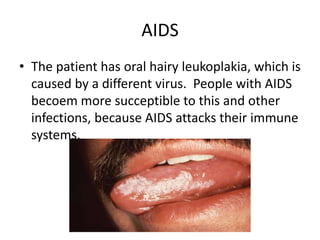 STI fight against germs tolive in this worls | PPT