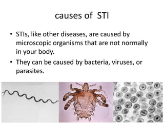 STI fight against germs tolive in this worls | PPT