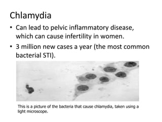 STI fight against germs tolive in this worls | PPT