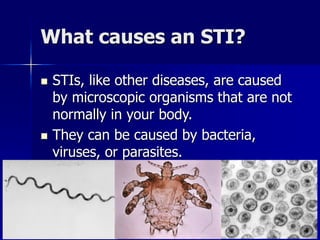 sti-unit.ppt