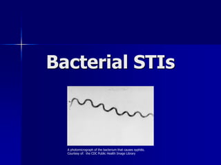 sti-unit.ppt