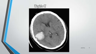 Stich ii trial for supratentorial intra cerebral bleed | PPTX
