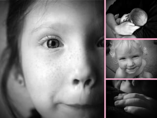 Sticky Eyes in Kids | PPT