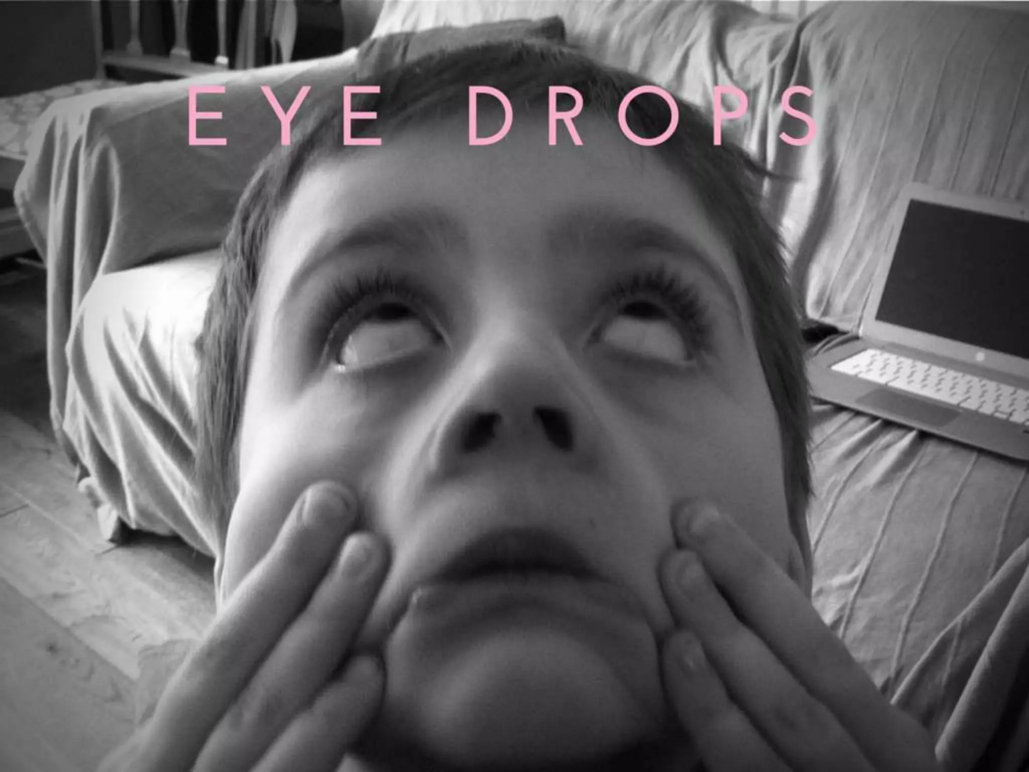 Sticky Eyes in Kids | PPTX