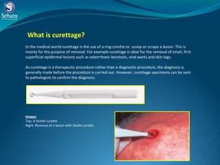 Stiefel biopsy punches and curettes | PPT