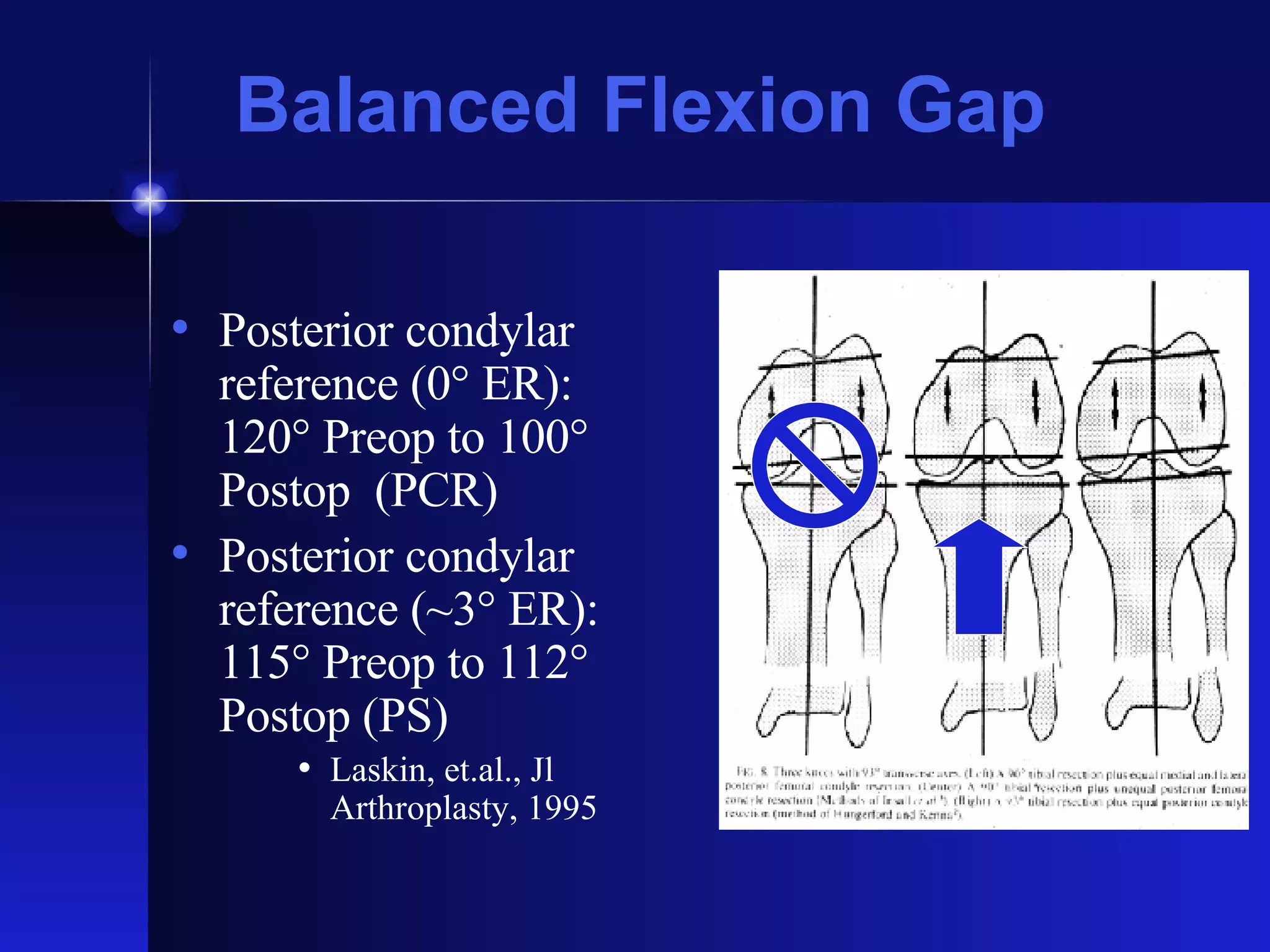 Stiehl Jb. Design Factors Influencing Rom In Tka | PPT | Death, Injury ...