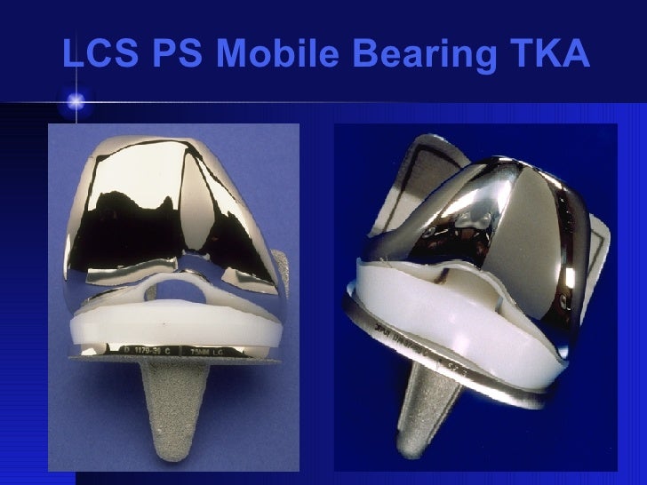 Stiehl Jb. Design Factors Influencing Rom In Tka