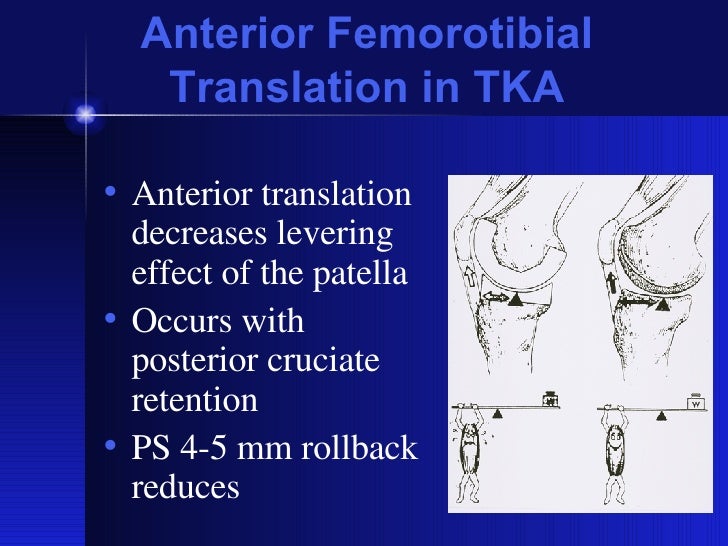 Stiehl Jb. Is Ps Needed In Tka