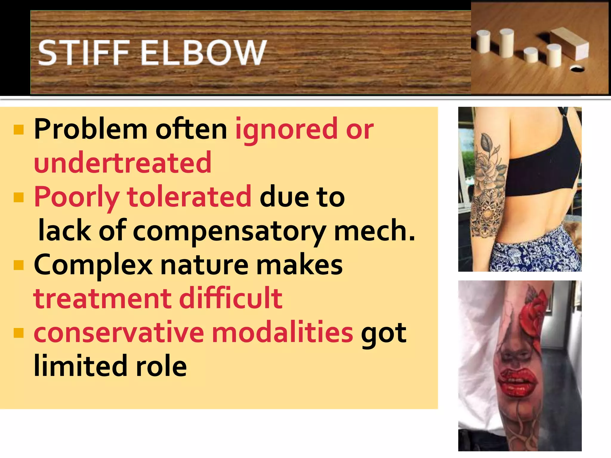Stiff elbow surgical management-dr mohamed ashraf HOD govt TD medical ...