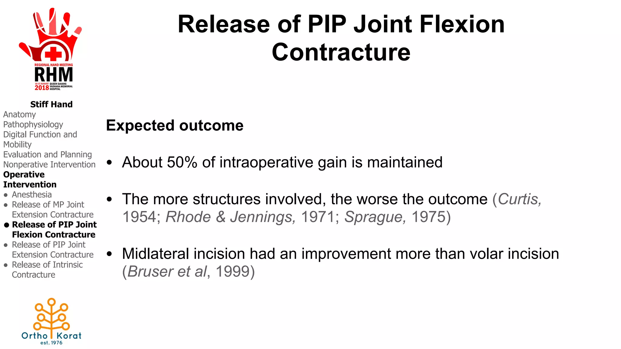 Stiff Finger | PPT