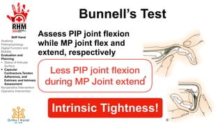 Stiff Finger | PDF