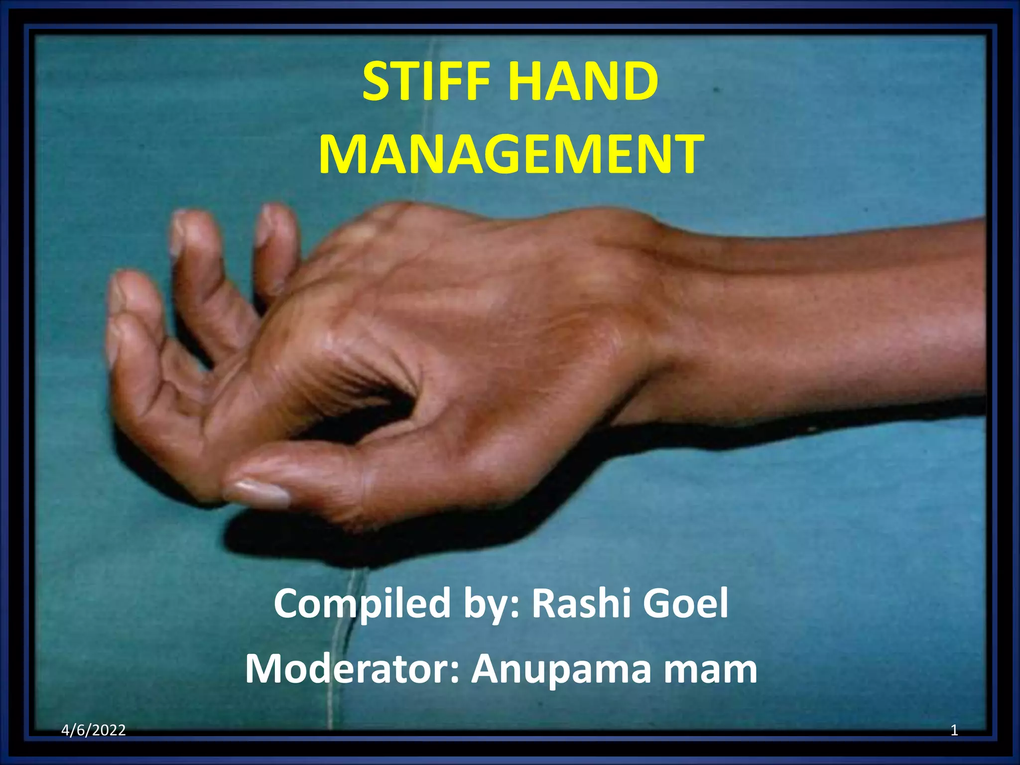 Stiff Hand Dr. Rashi Goel (PT) | PPT