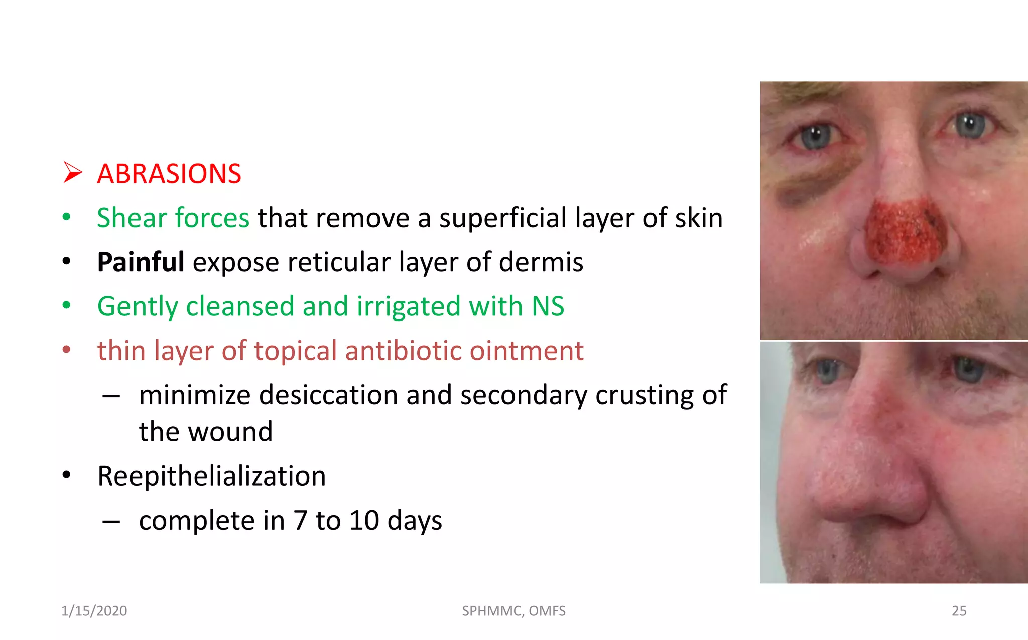 SOFT TISSUE INJURIES OF MAXILLOFACIAL REGION | PPTX