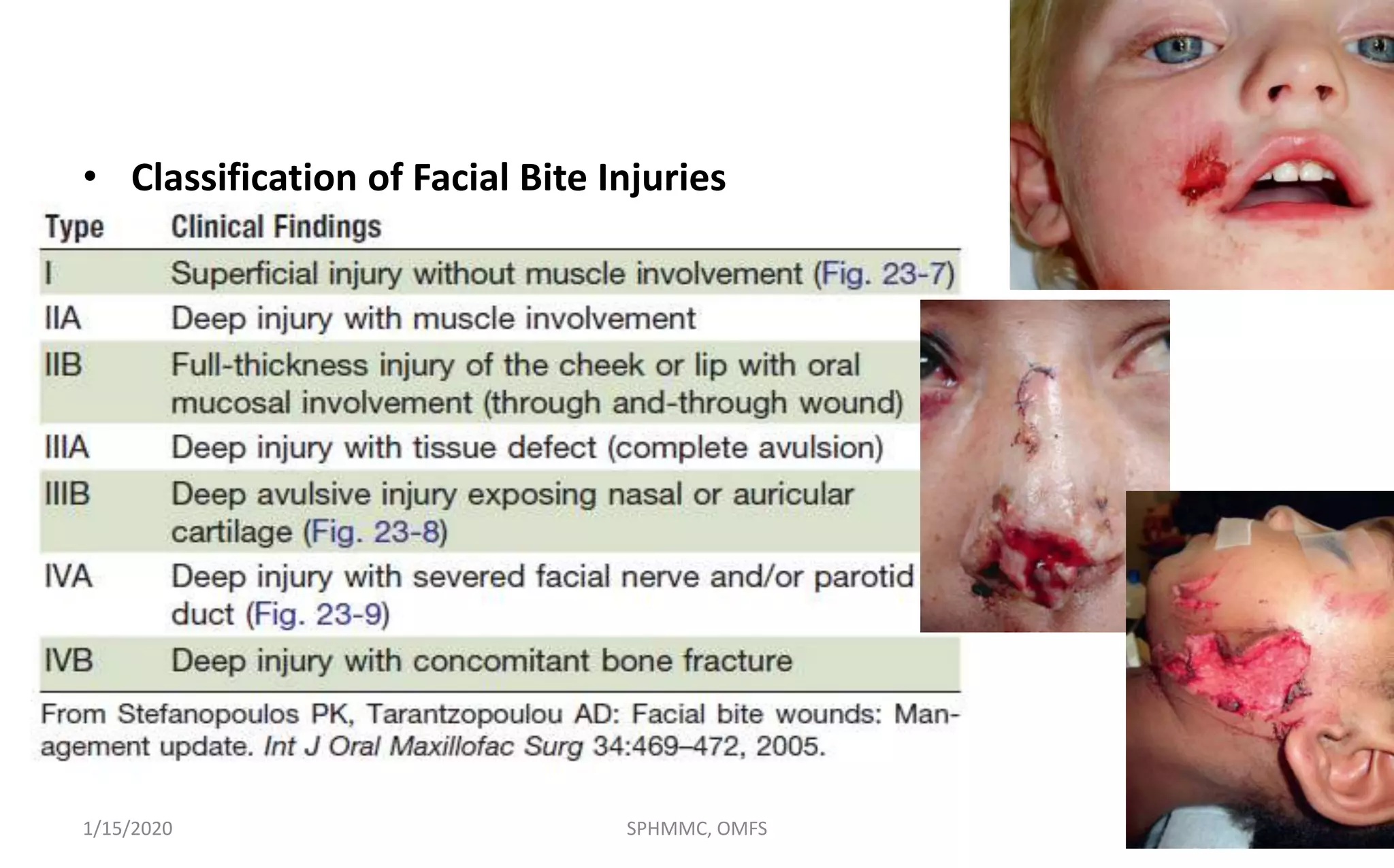 SOFT TISSUE INJURIES OF MAXILLOFACIAL REGION | PPTX