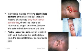 SOFT TISSUE INJURIES OF MAXILLOFACIAL REGION | PPTX