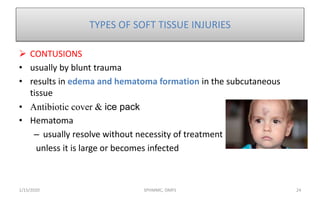SOFT TISSUE INJURIES OF MAXILLOFACIAL REGION | PPT