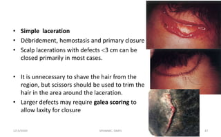 SOFT TISSUE INJURIES OF MAXILLOFACIAL REGION | PPT