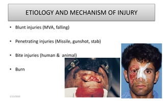 SOFT TISSUE INJURIES OF MAXILLOFACIAL REGION | PPT
