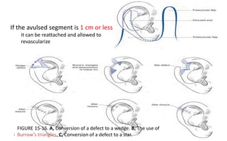 SOFT TISSUE INJURIES OF MAXILLOFACIAL REGION | PPT
