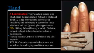 Presentation for stigmata of liver ppt.pptx
