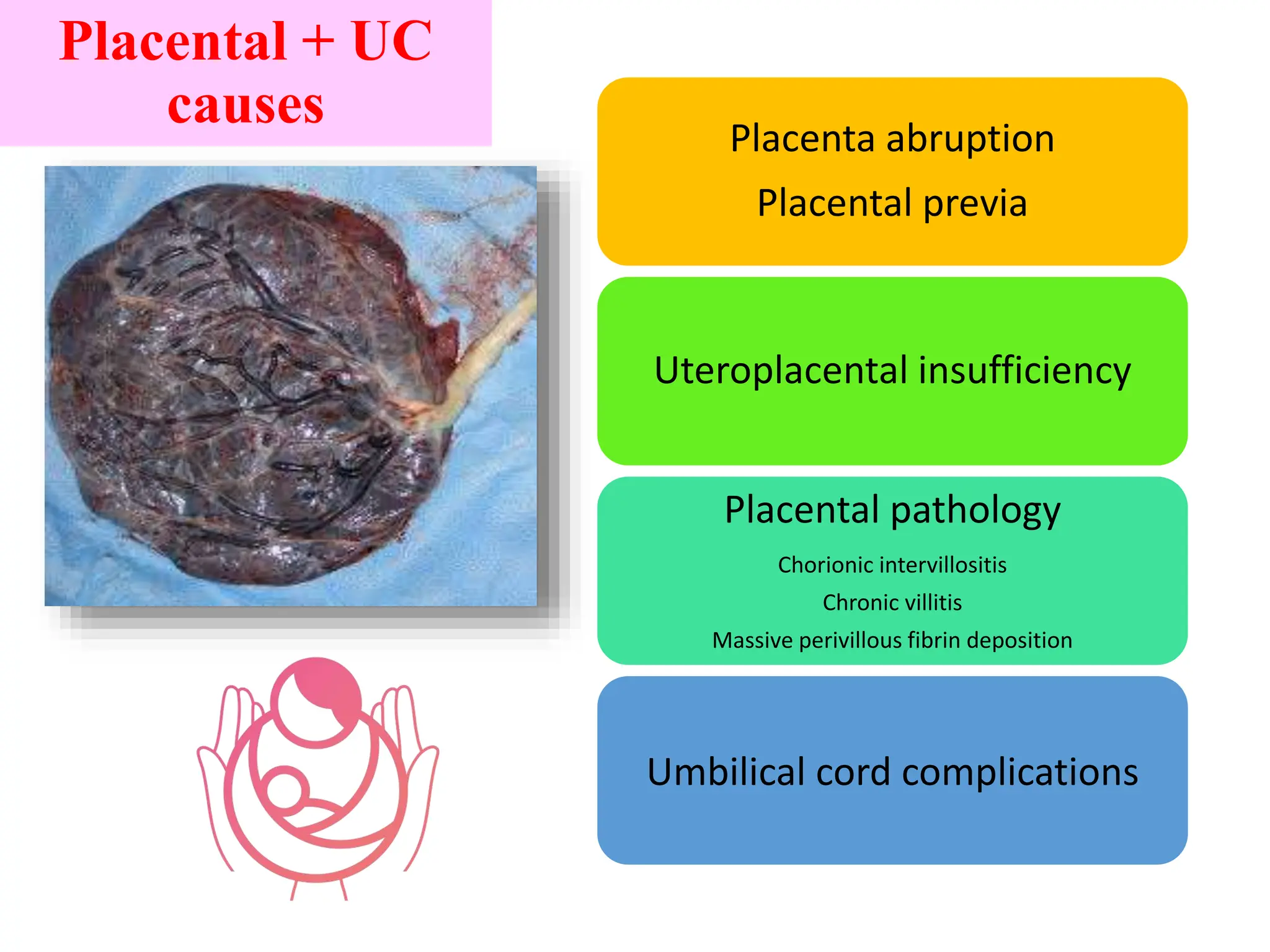 Still Birth:An Update : Dr Sharda Jain | PPTX