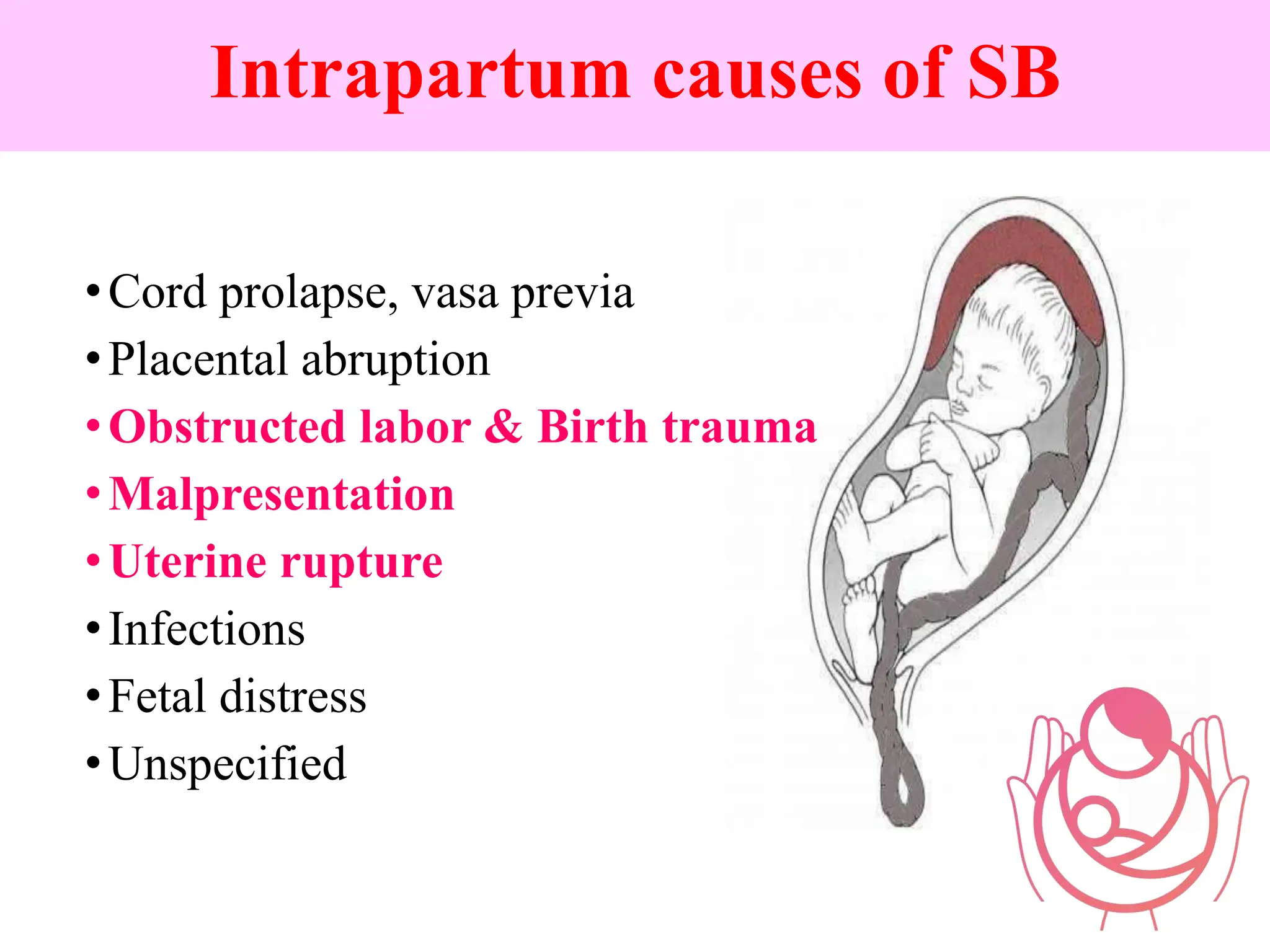 Still Birth:An Update : Dr Sharda Jain | PPTX