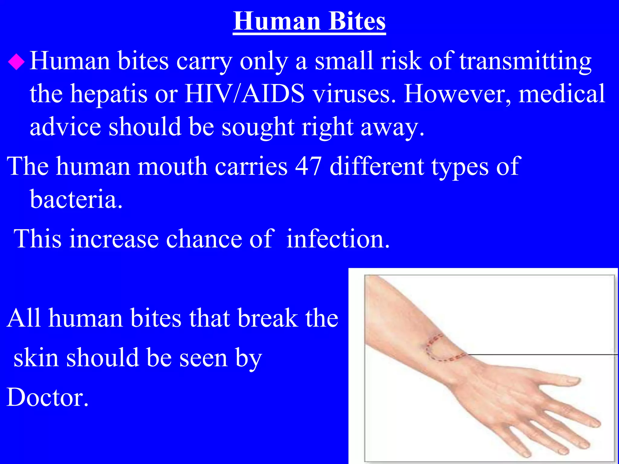 First Aid for Sting and bites | PPT