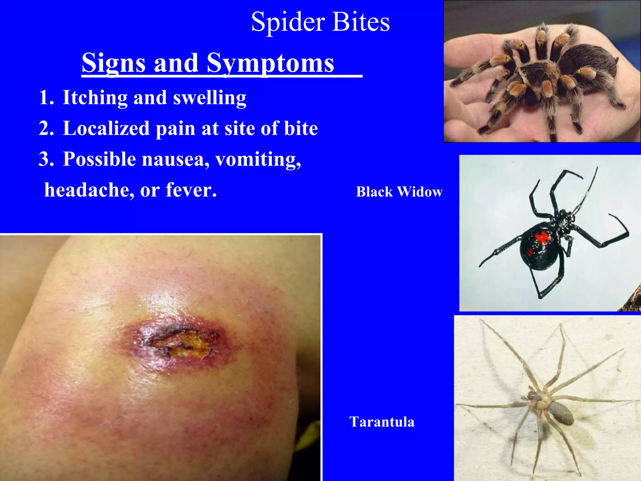 First Aid for Sting and bites | PPT