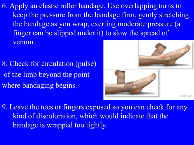 First Aid for Sting and bites | PPT