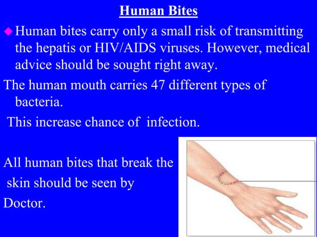 First Aid for Sting and bites | PPT