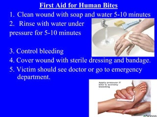 First Aid for Sting and bites | PPT