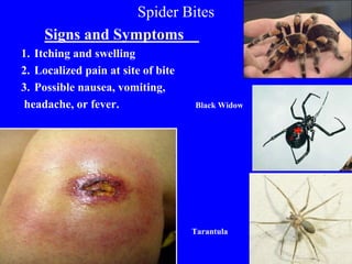 First Aid for Sting and bites | PPT