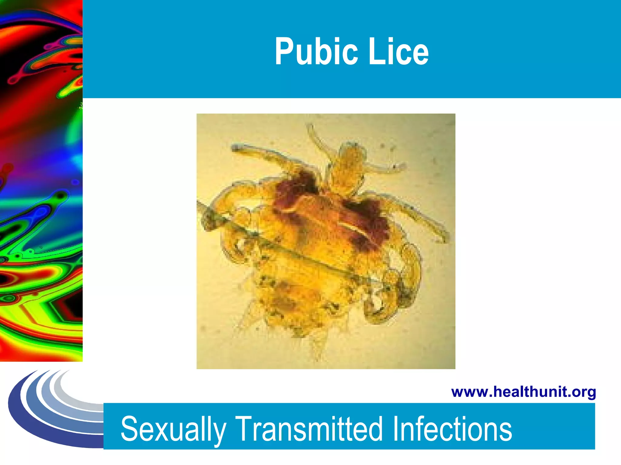 STI power point presentation | PPT