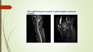 Fat suppression imaging | PPTX
