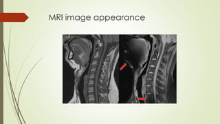 Fat suppression imaging | PPTX