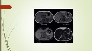 Fat suppression imaging | PPTX